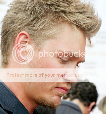 Broken Nose From Attackers Chad Michael Murray Pin on Chad Michael Murray